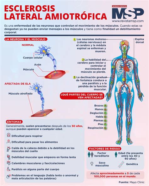 Ems Solutions International By Drramonreyesmd Marca Registrada