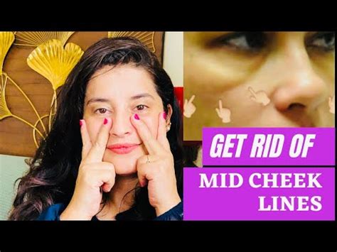 30 Get Rid Of Mid Cheek Lines Laugh Lines Facial Exercises To