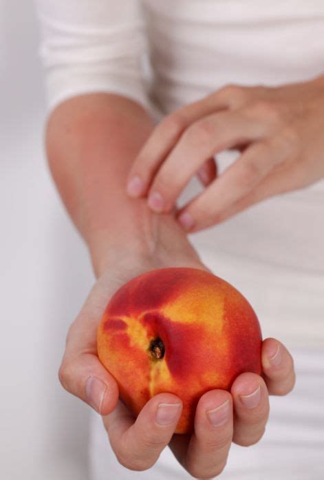 Food Allergy Sensitivity Testing Services Five Journeys
