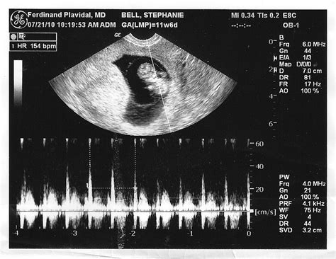 As 25 Melhores Ideias De Ultrasound Technician No Pinterest