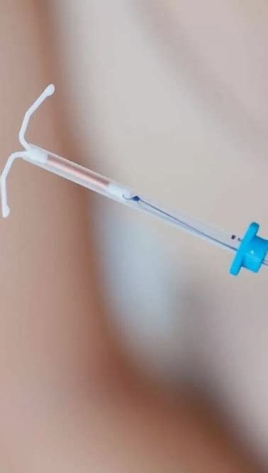 𝑫𝒓 𝑯𝒂𝒔𝒎𝒊𝒌 𝑯𝒂𝒓𝒖𝒕𝒚𝒖𝒏𝒚𝒂𝒏 🤰👶Հղիության 1 ին օրը 👩‍⚕️ Բժ Հասմիկ Հարությունյան 🏥