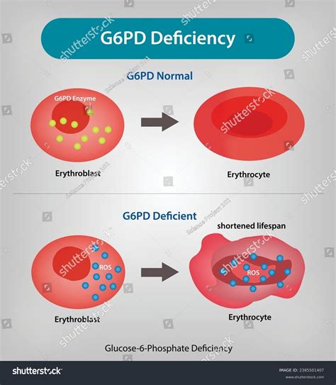 Glucose 6 Phosphatase