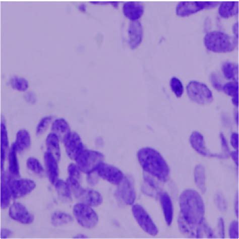 Nuclei Segmentation Dataset Kaggle