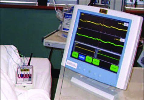 An EEG Monitoring Platform Infinite Biomedical Technologies Download Scientific Diagram