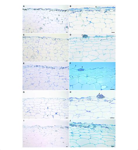 Longitudinal Semithin Sections Of The Phelloderm Of Asymptomatic A