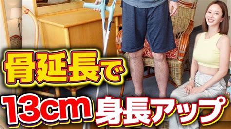 骨延長で13cm足を伸ばして低身長コンプレックス解消しました。 美容医療・整形情報♡動画まとめるん