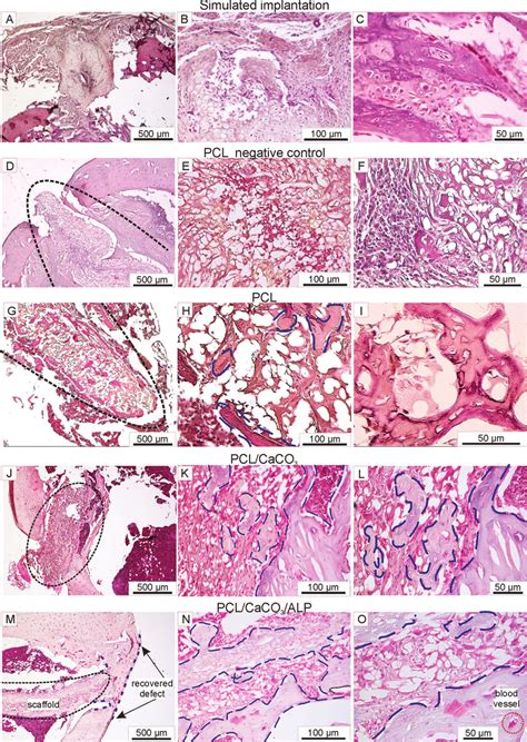 A O Cross Sections Of The Rat Femoral Bone With Implanted Scaffolds Download Scientific