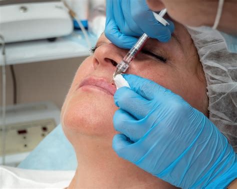 Premium Photo Lip Augmentation Lip Correction Hyaluronic Acid