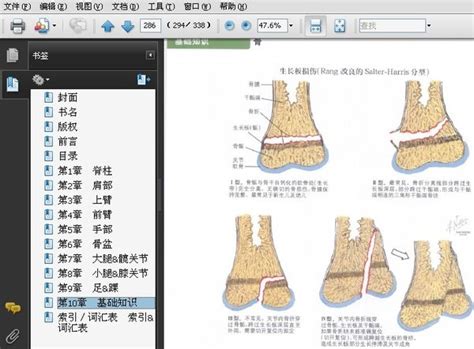 资料下载奈特简明骨科学彩色图谱 邱贵兴 扫描版 pdf