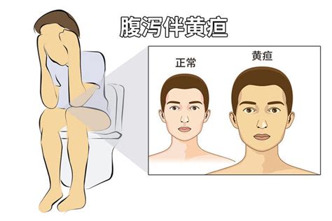 全球约一半肝癌在中国，再三提醒：家中的4种食物，尽早撤下餐桌