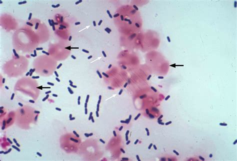 Pin On Microbiology