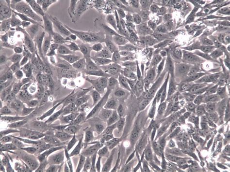 Ges 1ges1 人胃粘膜上皮细胞 上海盖宁生物科技有限公司 专业细胞供应【官方网站】