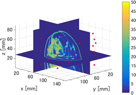 Tdoa Based Microwave Imaging Algorithm For Real Time Microwave Ablation Monitoring