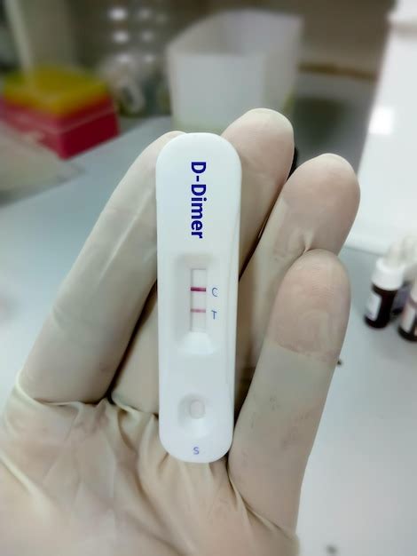 Premium Photo Rapid Diagnostic Cassette For D Dimer Test