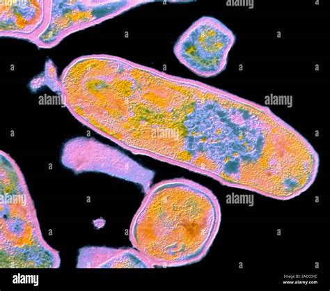 False Colour Transmission Electron Micrograph Tem Of Corynebacterium