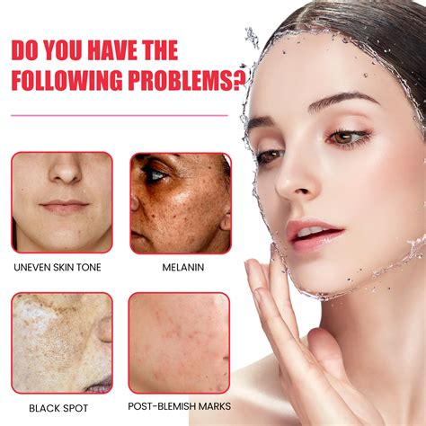 Fading Dark Spots On Face