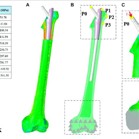 Finite Element Model Of The Femur And Prosthesis A Material