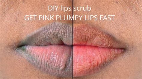 Diy How To Get Pink Lips Fast Permanently And Naturally At Home Easy