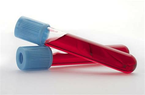 Reverse T3 Only Dr Hagmeyer Get Tested Today