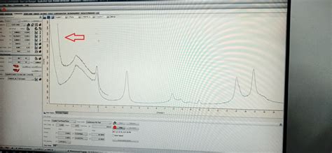 69 Questions With Answers In XRD X RAY DIFFRACTION Scientific Method