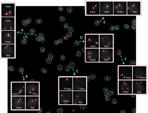 Fluorescence Signal Detection Based On The Multi Scale Download