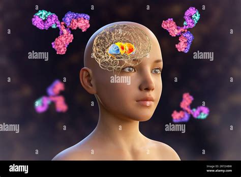 Anti Basal Ganglia Antibodies Abga Conceptual Computer Illustration