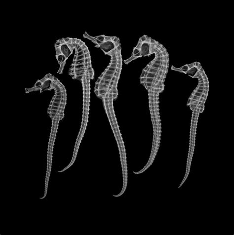 Interesting X Rays A Gallery On Flickr