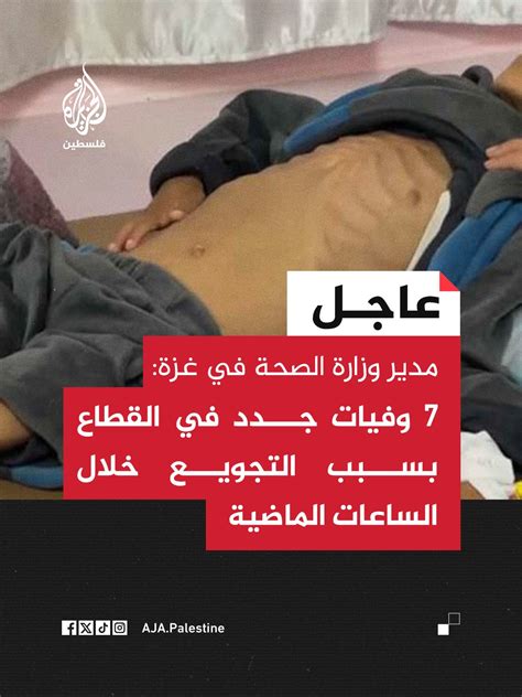 الجزيرة مدير وزارة الصحة في غزة للجزيرة 7 وفيات جدد في القطاع بسبب