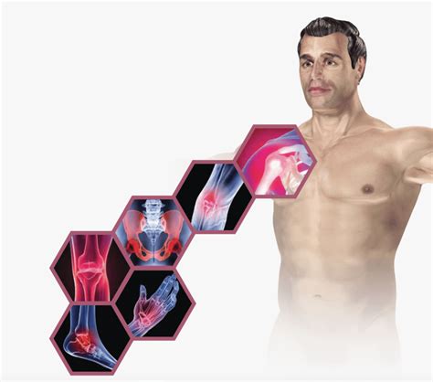 Cyrex Array 8 Joint Autoimmune Reactivity Screen Thrive Store
