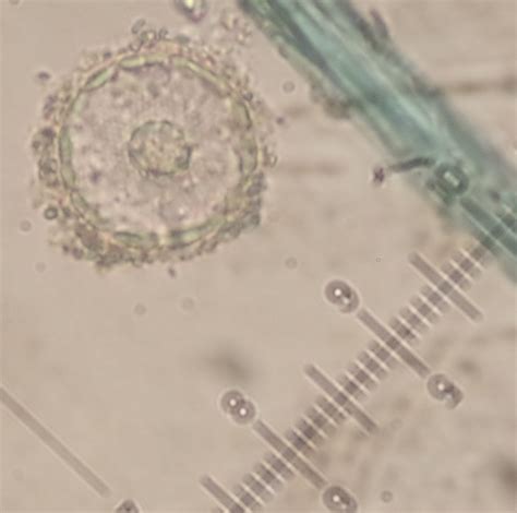 Could You Help To Identify Centric Diatom Form The Black Azov Seas ResearchGate
