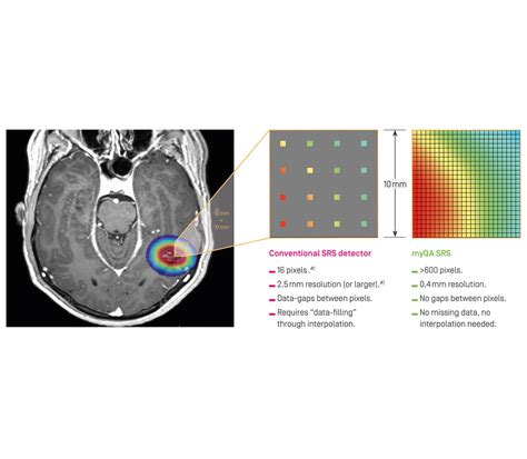 Iba Dosimetry Myqa Srs Accuracy Of Film Qa