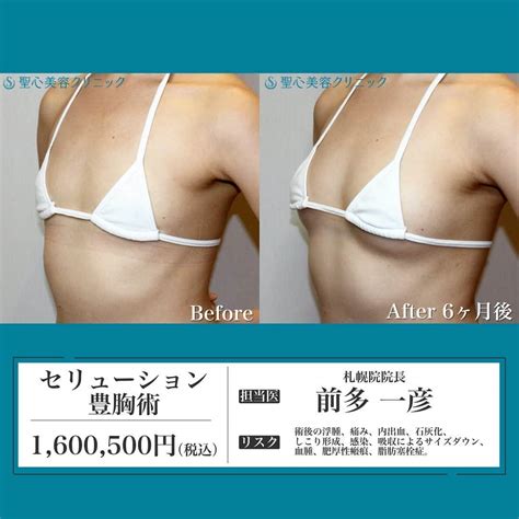 聖心美容クリニック公式アカウント さんのインスタグラム写真 聖心美容クリニック公式アカウント Instagram「 20代セリ