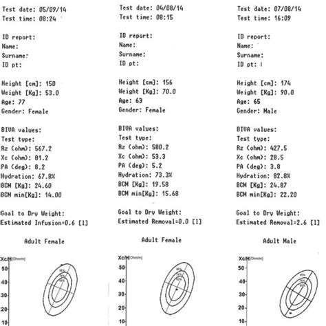 Admission Bioelectrical Impedance Vector Analysis Data Haemodynamics