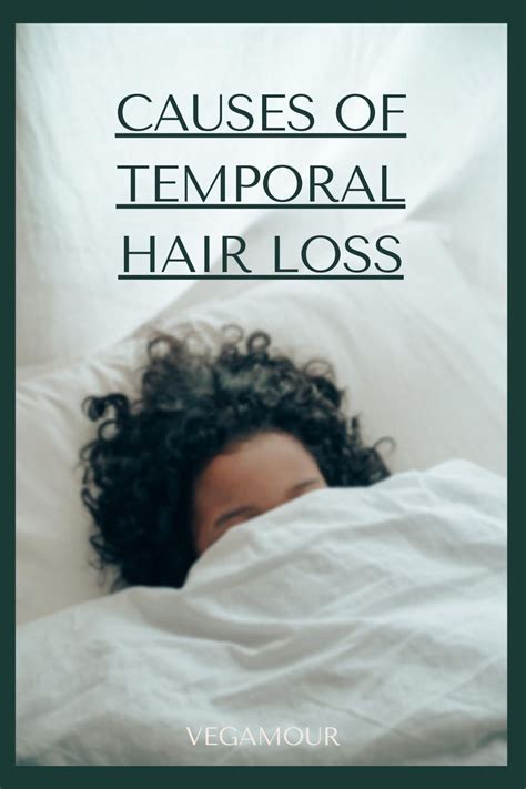 Temple Hair Loss Artofit