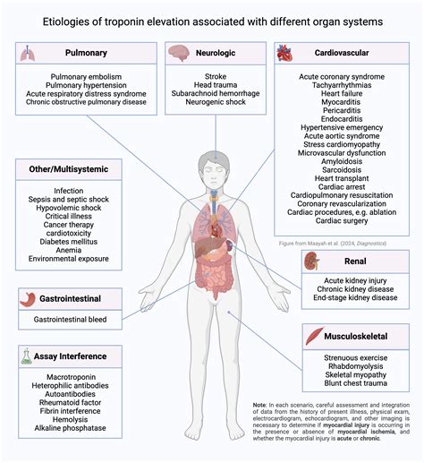 Etiologies Troponin Toolbox