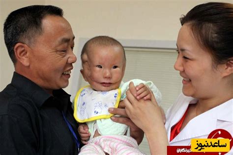 بچه‌ای که با یک ماسک بر صورت متولد شد تصاویر