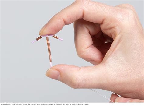 Paragard Copper Iud Mayo Clinic