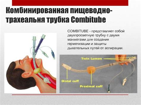 Методы обеспечения проходимости дыхательных путей. Коникотомия ...