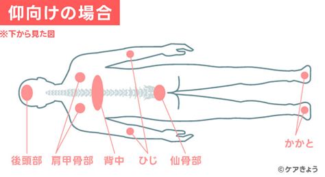 褥瘡 床ずれ）予防どうする？褥瘡の好発部位と原因4つ ケアきょう