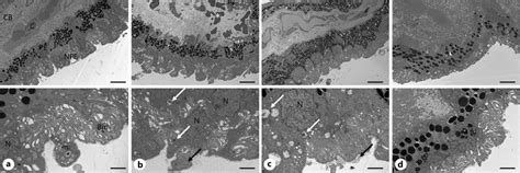Electron Microscopy Of Ciliary Body A Control Eye Ciliary Body Cb