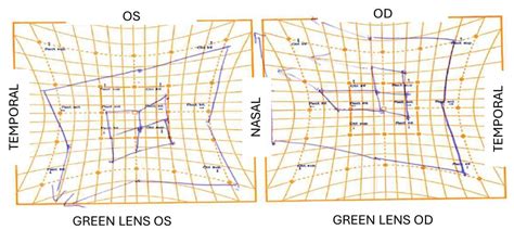 The Hess Test Eyewiki