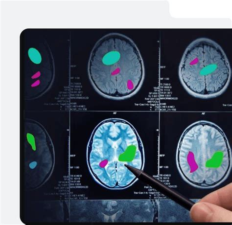 Data Annotation For Healthcare Ark Infotech