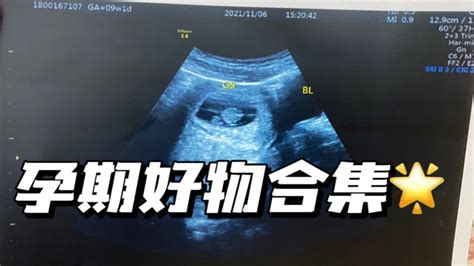 【购物分享】一次就中！从备孕到坐月子准妈妈必备！这些不必着急买！ Youtube