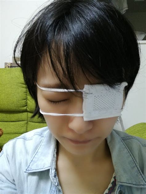 眼帯 流産を経て二人の宝物に出逢う。しーちゃんの日々のあれこれ