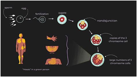 Why Do Some People Have Down Syndrome · Frontiers For Young Minds