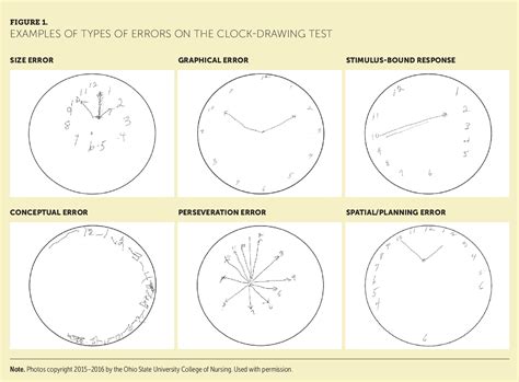Figure 1 From Cognitive Screening Using The Clock‐drawing Test To