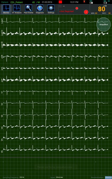 Ads Noise Due To Power Frequency Magnetic Field Data Converters