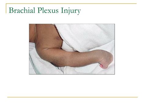 Ppt Orthopedic Physical Assessment Powerpoint Presentation Free