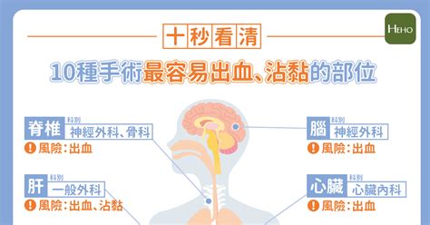 手術風險一次看 10 個最容易出血、沾黏部位！ Heho健康