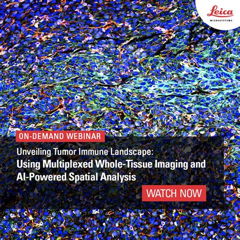 Leica Microsystems On Linkedin Explore How Spatial Multiplexing And Ai